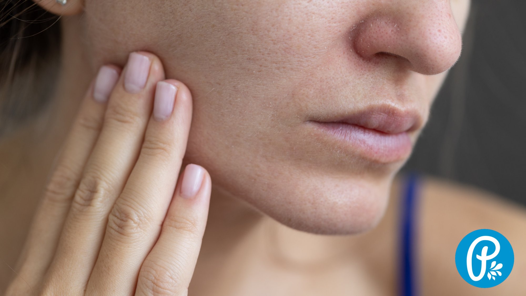 Suchá pleť - ako sa o ňu správne starať - PANAKEIA